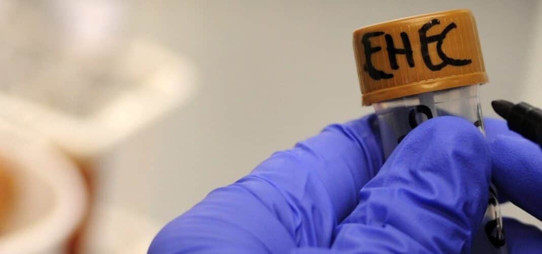 EHEC: Suche nach der Infektionsquelle in MV ist äußerst herausfordernd